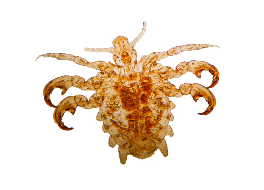 Kopflaus - Rheinland Schädlingsbekämpfung